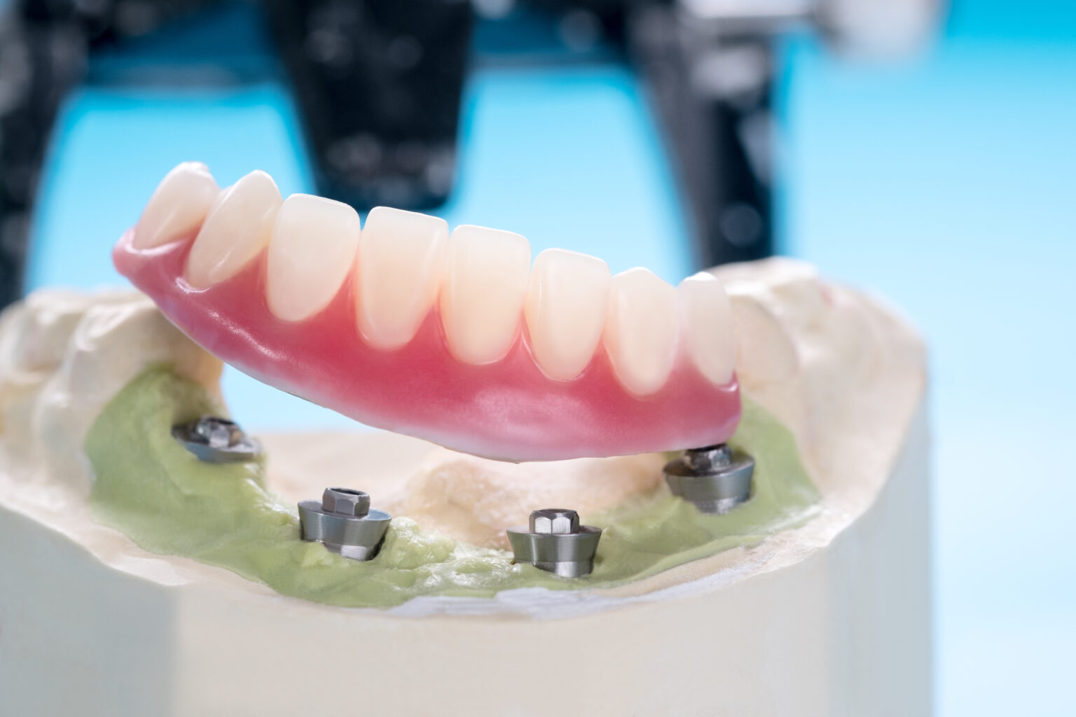 Hybrid Dentures Provide A New Smile - Shrewsbury Implant